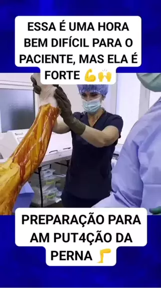 tinymodelmorika & tinymodelmoriko content| Discove ...| SnackVideo